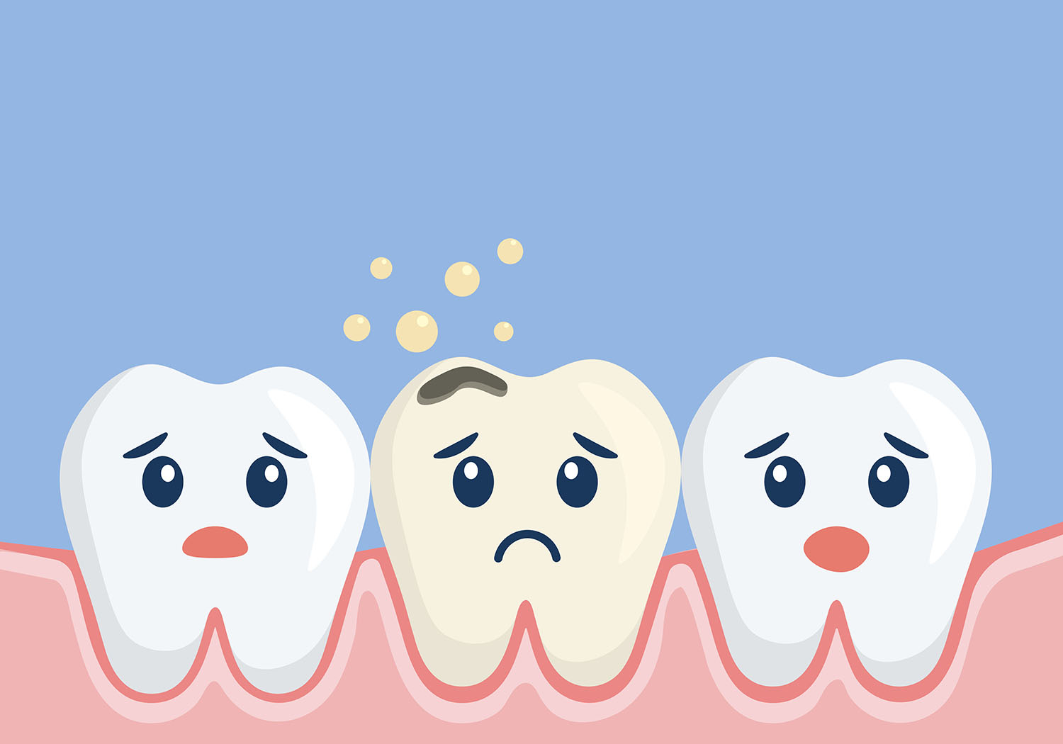 Tooth Talk: What is an Abscessed Tooth? - myDental