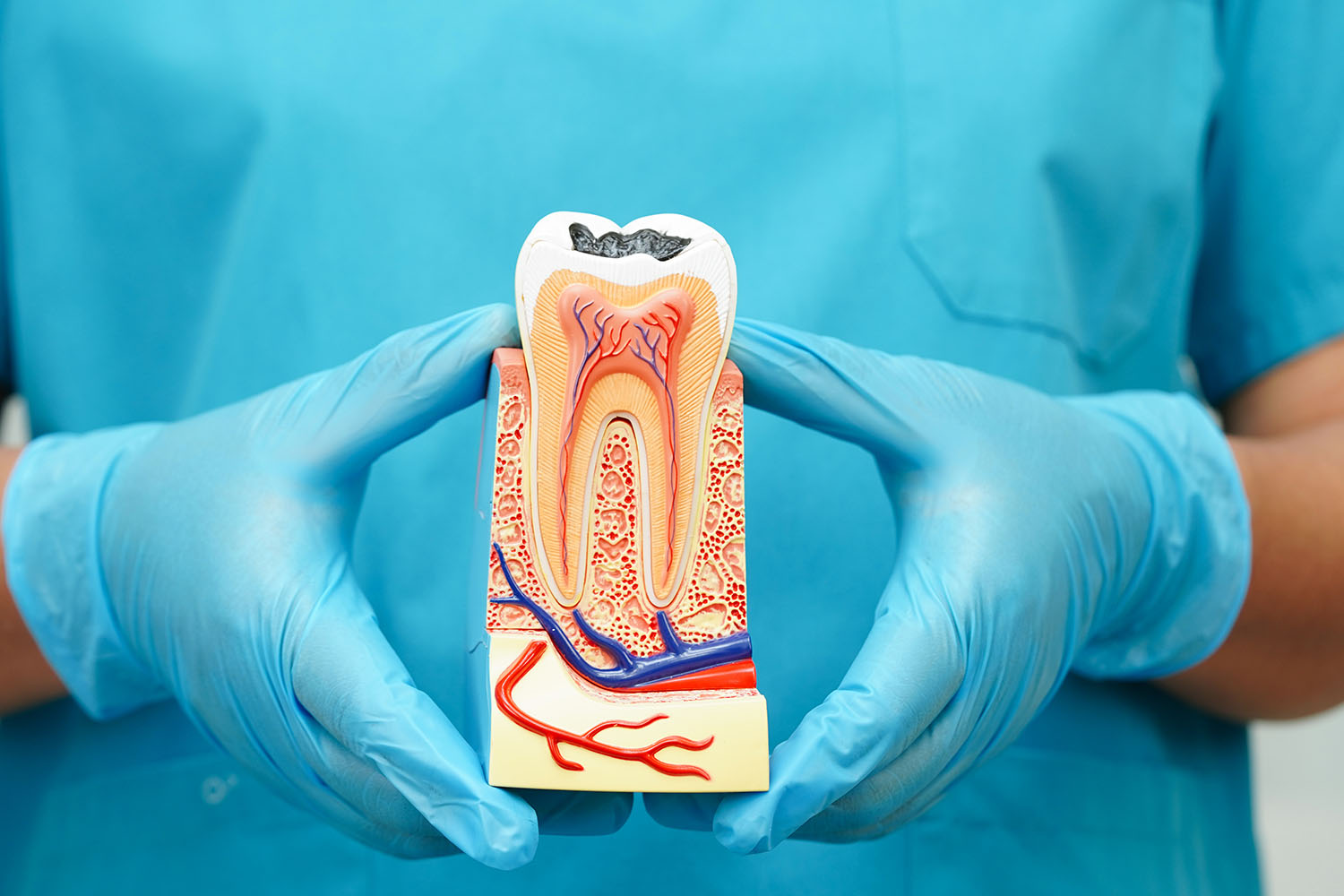 How Dangerous is an Untreated Root Canal Infection to Your Health ...