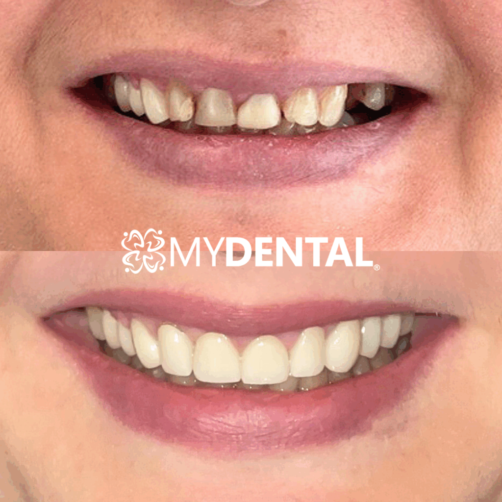 Smile Gallery - myDental