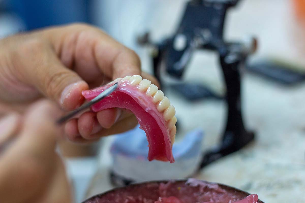 How to Deal with a Rotten Tooth: Treatment Options | myDental